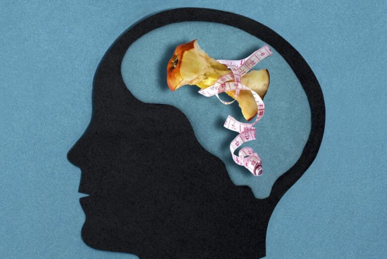 What Is The Most Common Medication For Anorexia Nervosa - Emlii